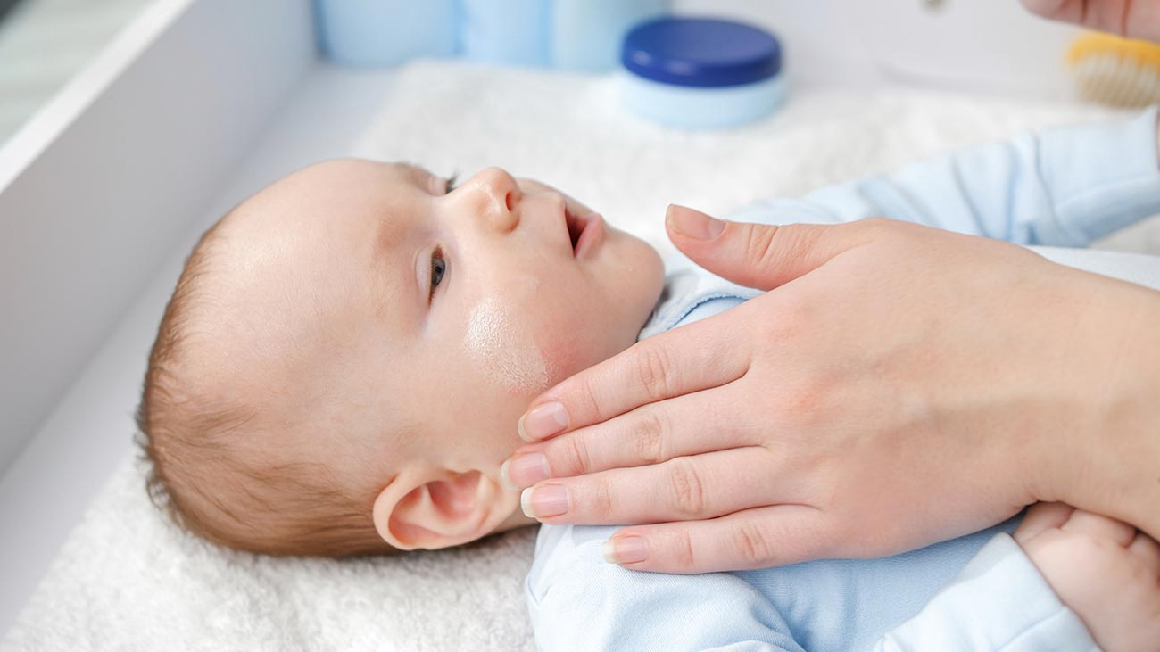 Method Of Preventing Milk Rash - FBIO